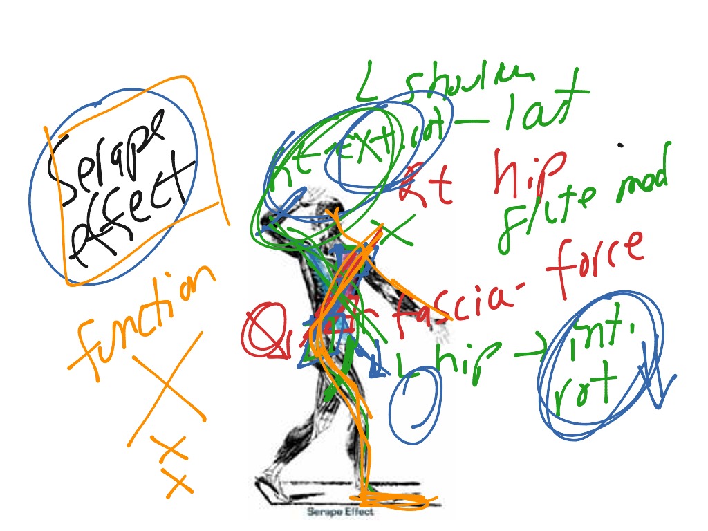 Serape effect | anatomy, Physiology | ShowMe
